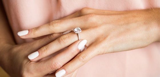 Preventing Skin Irritation from Your Ring Blog